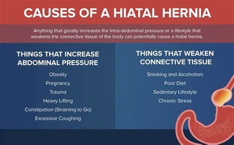 Symptoms Of Failed Hiatal Hernia Repair At Katherine Lederman Blog