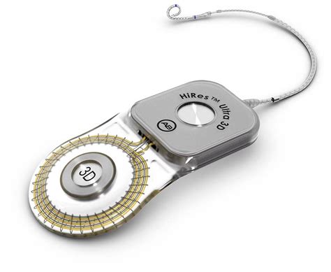 Reliability Advanced Bionics