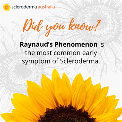 Scleroderma Australia On Linkedin Raynauds Phenomenon Raynauds Phenomenon Is The Most Common