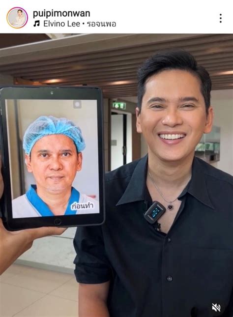 เรียกพ่อไม่ได้แล้ว แมว จิรศักดิ์ หลังศัลยกรรมลดอายุ ตอนนี้หน้าเด็กมาก