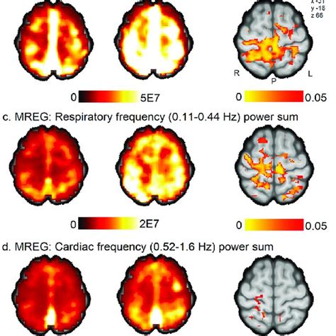 Eeg Slow Oscillation 02 2 Hz Power Increased In Spatially