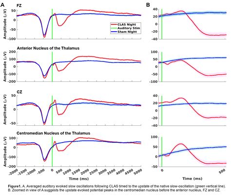 Evidence Of Evoked Slow Oscillations In The Human Thalamus Following Closed Loop Auditory