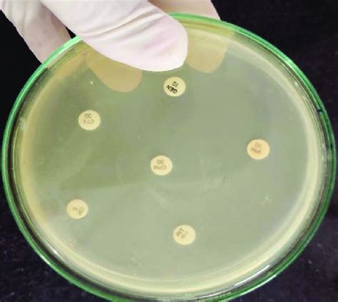 Isolated Multidrug Resistant Acinetobacter Baumanii Is Clearly Shown Isolated Multidrug Resistant Acinetobacter Baumanii Is Clearly Shown