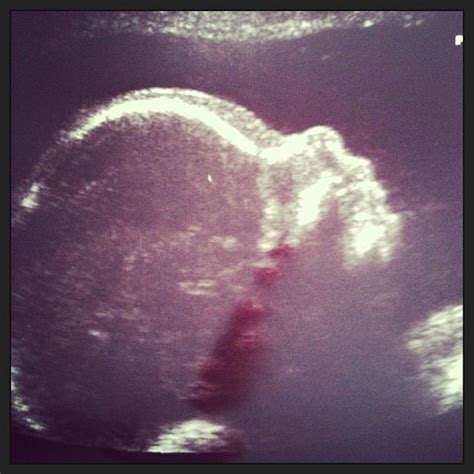 Tessa Rayanne 21 Weeks Pregnant Update