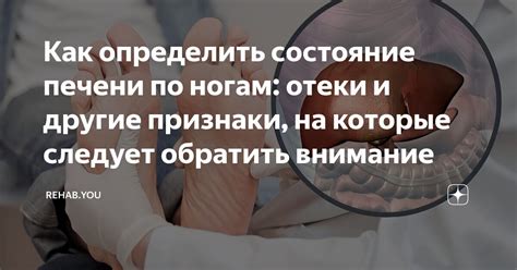 Как определить состояние печени по ногам отеки и другие признаки на которые следует обратить