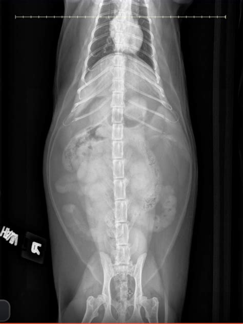 Case Review Radiographic Signs Of Linear Foreign Body Obstruction In A