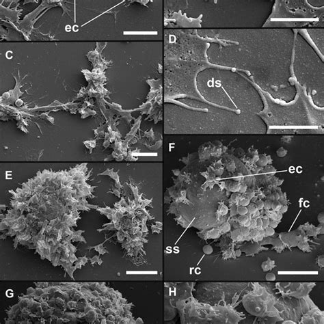 Floating Hemocyte Aggregates Transmission Electron Microscopy A