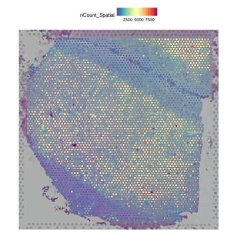 Spatial Transcriptomics Putting It All Together