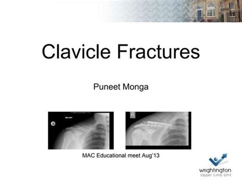 Subtalar Dislocation Pdf