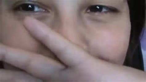 A Girl Showing Long Uvula And Huge Tonsils