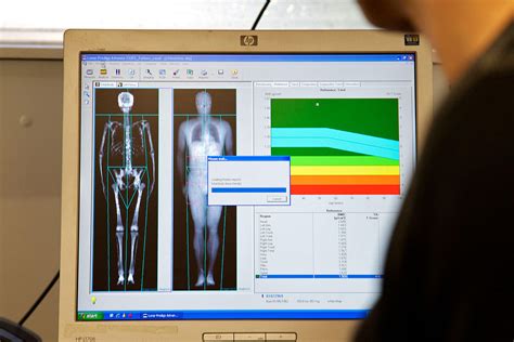 Dexa Scan In Bristol Accurate Body Composition Analysis