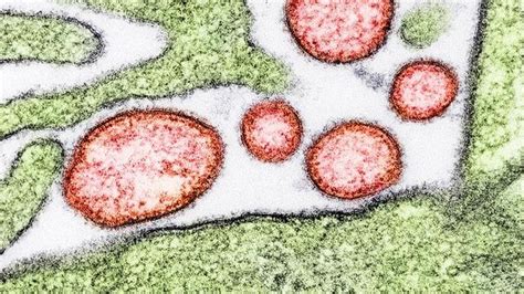 Clinical Trial Of Mrna Nipah Virus Vaccine Launched Technology Networks