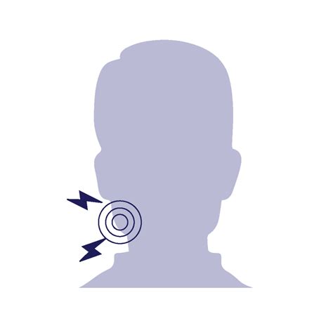 Surgery For Trigeminal Neuralgia Active Rehab