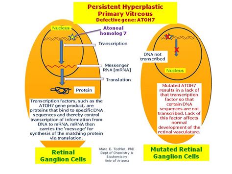 Persistent Hyperplastic Primary Vitreous Hereditary Ocular Diseases