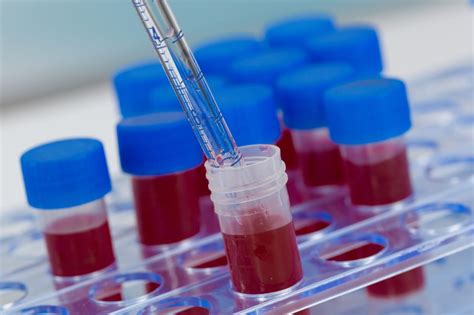 Polymorphprep Density Gradient Media