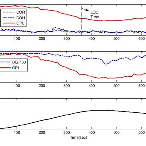 An Example Of The EEG Measures A B And Simultaneous Effect Site Download Scientific Diagram