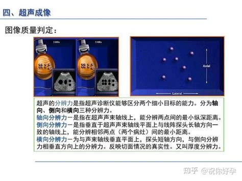 超声成像的基本原理 知乎
