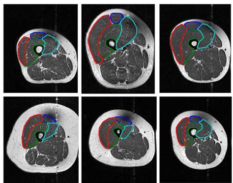 Atlas Images For Each Sex With Differing Relative Fat Muscle Content Download Scientific