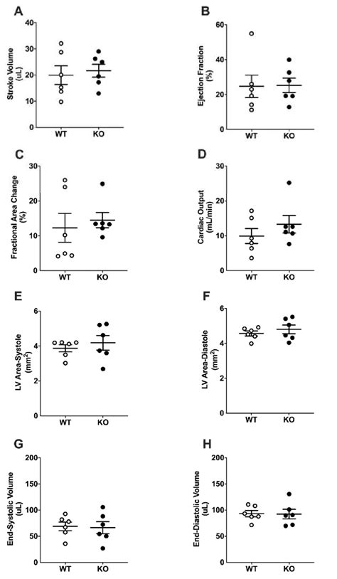 Cardiac Dimensions And Function Following Myocardial Infarction Mi