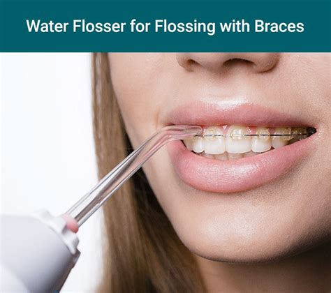 How To Floss With Braces Gibbs Orthodontic Associates