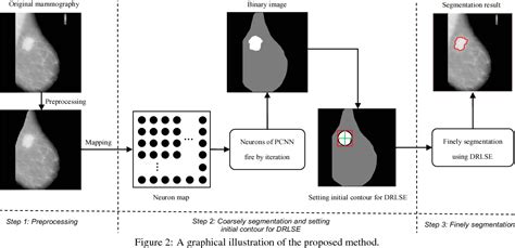 Figure 1 From Automated Breast Mass Segmentation Using Pulse Coupled