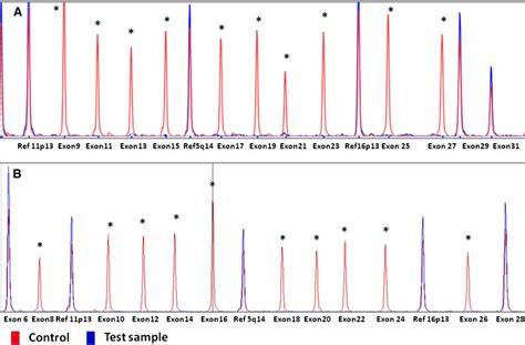 Multiplex Ligation Dependent Probe Amplification Analysis Revealing Download Scientific Diagram