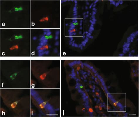 Hap1 And 5 Ht Localization In Villi From Healthy Human Duodenum A E