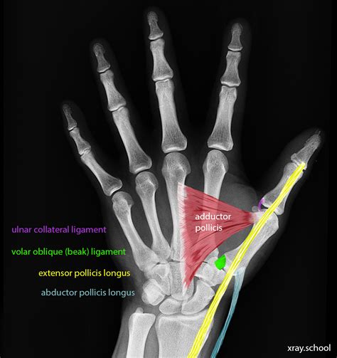 Thenar Muscles And Ligaments Xray School