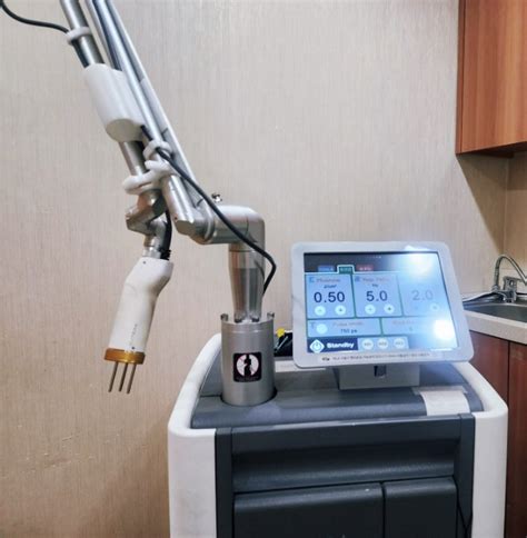 노원역 피부과 흑자 제거 후기 가격흑자치료레이저