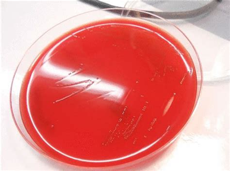 Streptococcus Thermophilus Gram Stain