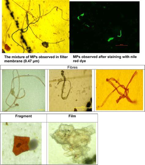 Different Morphotypes Of Mps Of Clam Meat Observed Under The Microscope