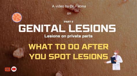 What To Do After Spotting Genital Lesions Next Steps And Treatment Options YouTube