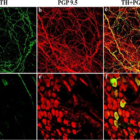 Th Ir And Pgp 95 Ir Neurons And Axons In The Icg In The Atria Download Scientific Diagram