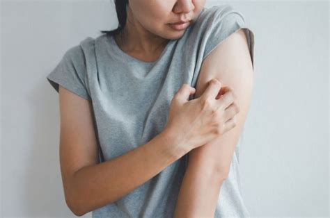 Gatal Jangan Langsung Di Garuk Ini Cara Untuk Atasi Gatal Tanpa Luka