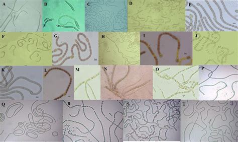 Native Cyanobacterial Strains Found In Tehran Waterfall A Calothrix Download Scientific