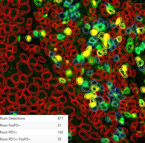 Danishbioimaging Workshop Microscopy Imageanalysis Danish Bioimaging