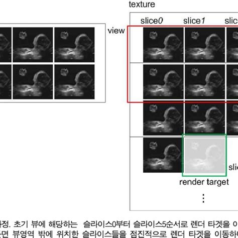 Imagej Application Displaying Overhead View Of Mri Of The Head And Neck