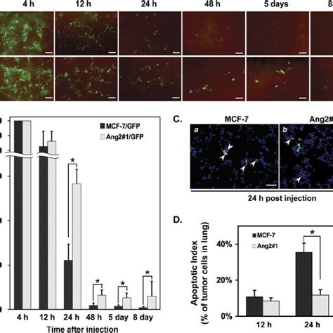 C Myc Overexpression 3 In Portio Vaginalis Uteri Invasive Carcinoma Download Scientific