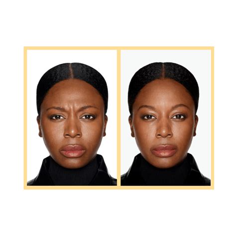 DAXXIFY Neuromodulator You Medical Aesthetics Med Spa Treatments