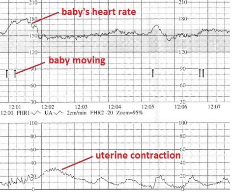 The Infertile Breeder