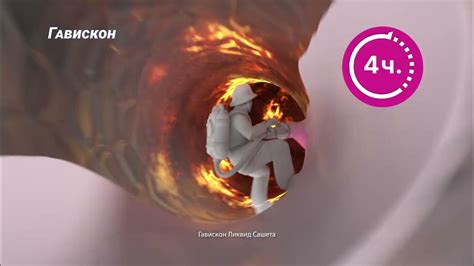 Гавискон бързо решение при 4 симптома на стомашни киселини Youtube