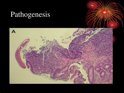 Ppt Trichostrongylus Spp Powerpoint Presentation Free Download Id 3824497