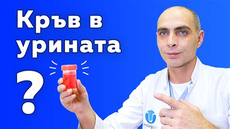 Кръв в урината