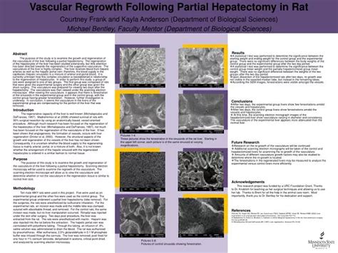 Ppt Vascular Regrowth Following Partial Hepatectomy In Rat Powerpoint