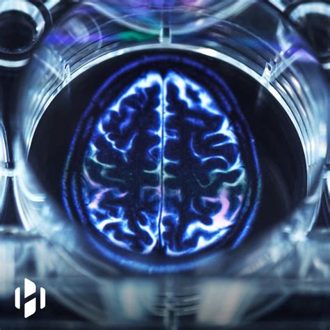 Hashem Al Ghaili On Linkedin Science Research Health Medicine Neuroscience Brain 25