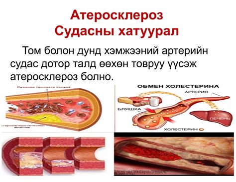 Energy Судас хатуурах өвчний тухай 📚🧠