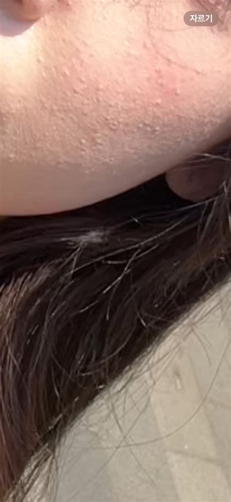 의사에게 물어보세요 피부가 화장을 하고 강남언니 1등 성형수술and피부시술 정보앱