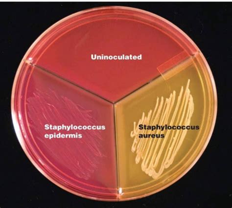 Mbio Lab Final Flashcards Quizlet