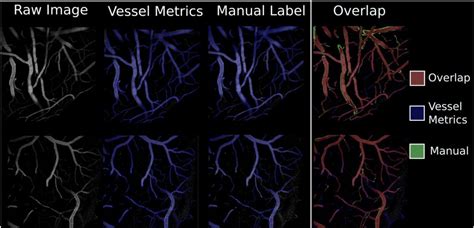 Microscopy Preprints Bioimage Analysis Tools Focalplane