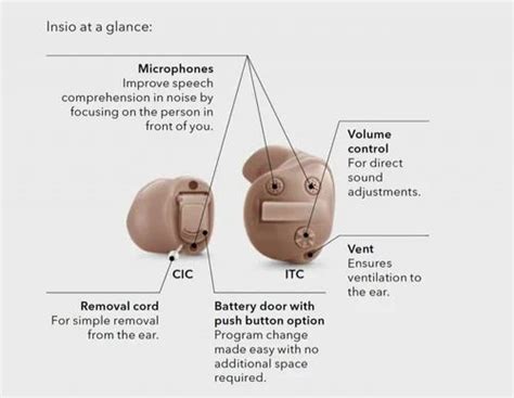 Siemens Insio Ite Itc 1 Nx In The Canal At Best Price In Chennai Id 19598861648
